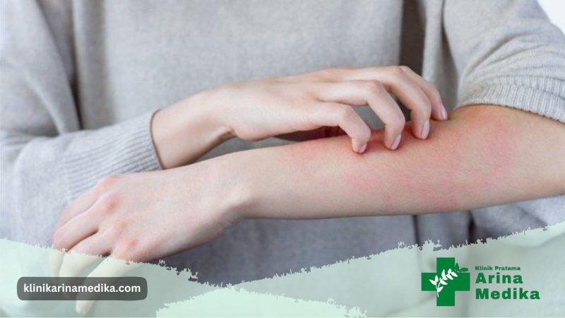 Alergi Dingin Kenali Penyebab, Gejala,dan Cara Mengobatinya - ARINA MEDIKA